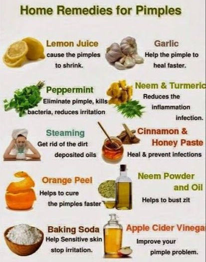 Best remedy for pimples store